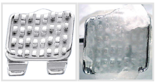 Mini-Sprint Brackets - Orthodontic Supplies Australia