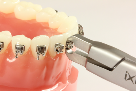 Ixion Direct Bond Remover - Orthodontic Supplies Australia